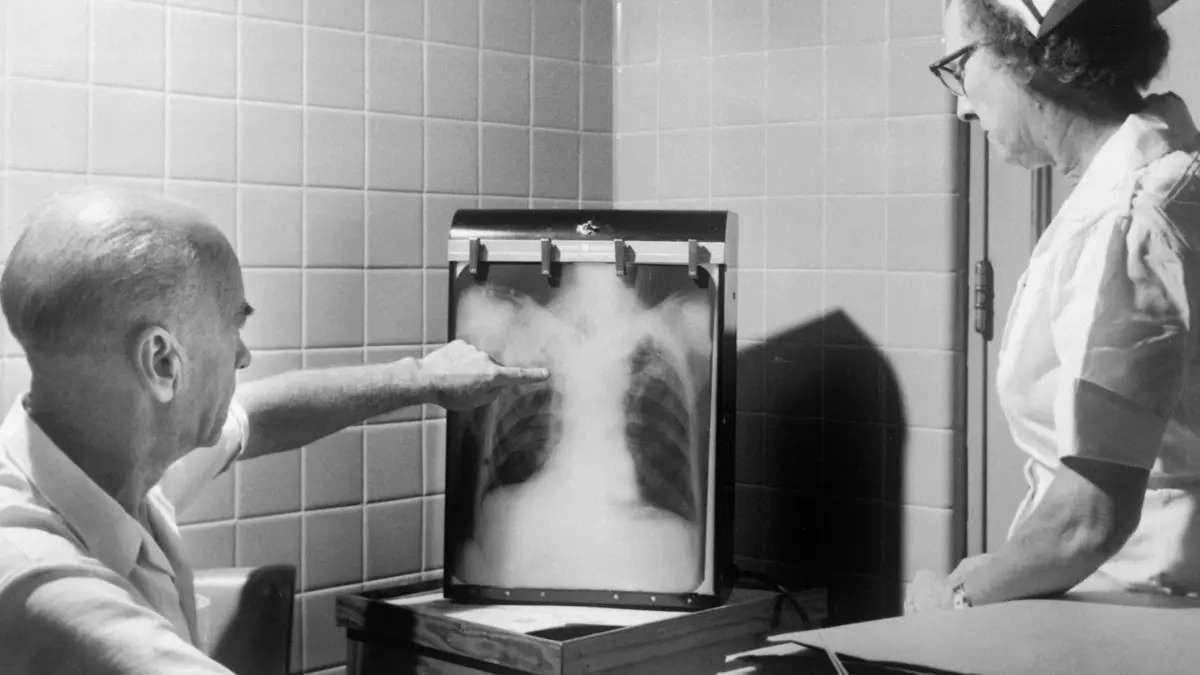 Lung Cancer Metastasis: 5 Sites, Signs and Key Treatments